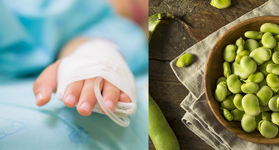 نقش G6PD در ایجاد بیماری فاویسم (Favism) - آزمایشگاه تشخیص ژنتیک ایراژن